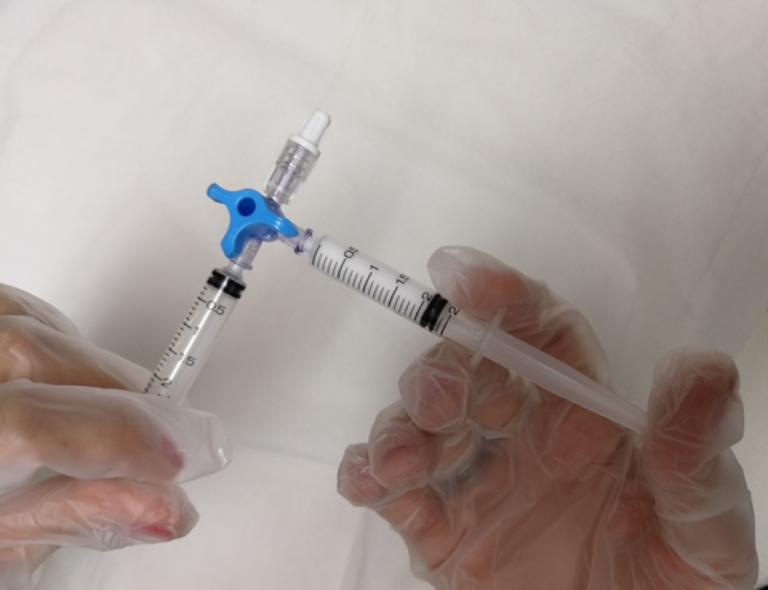 La sclérothérapie mousse dans le traitement des varices